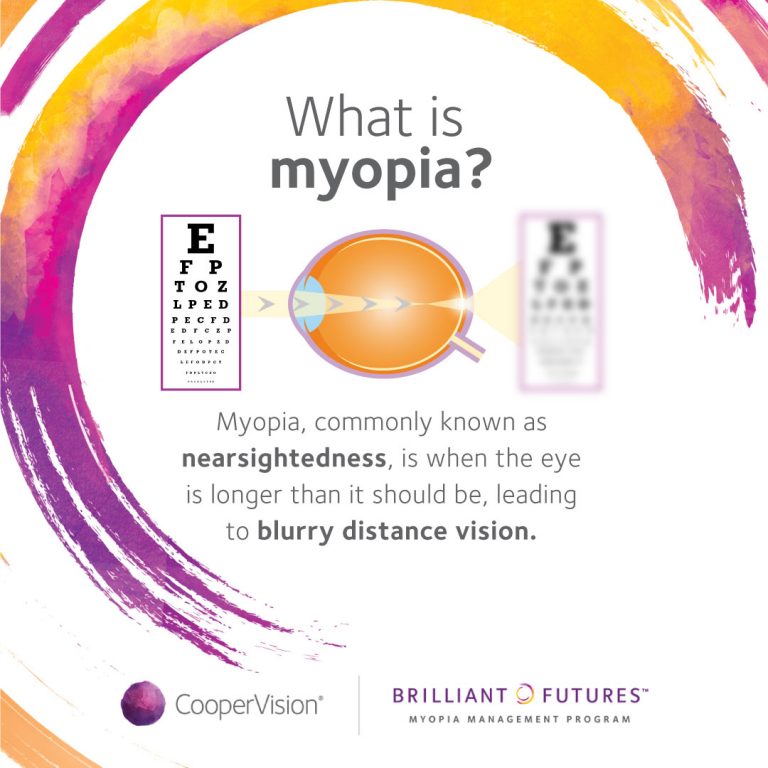 Myopia Management in Clayton & Creve Coeur, MO | Optical Expressions